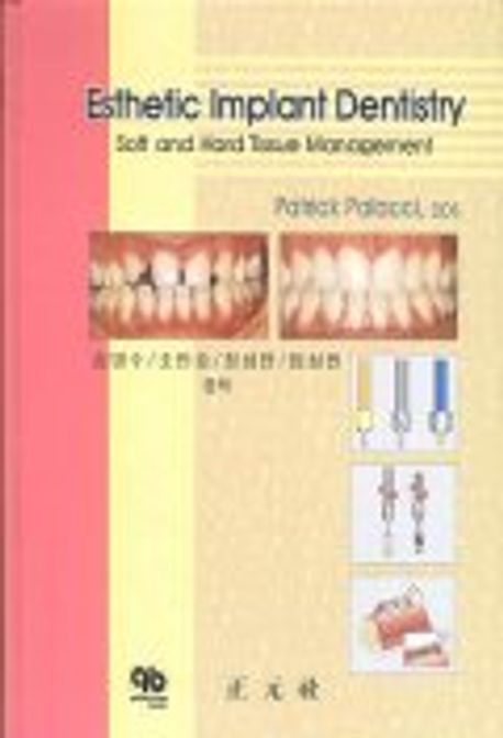 ESTHETIC IMPLANT DENTISTRY | PATRICK PALACCI - 교보문고