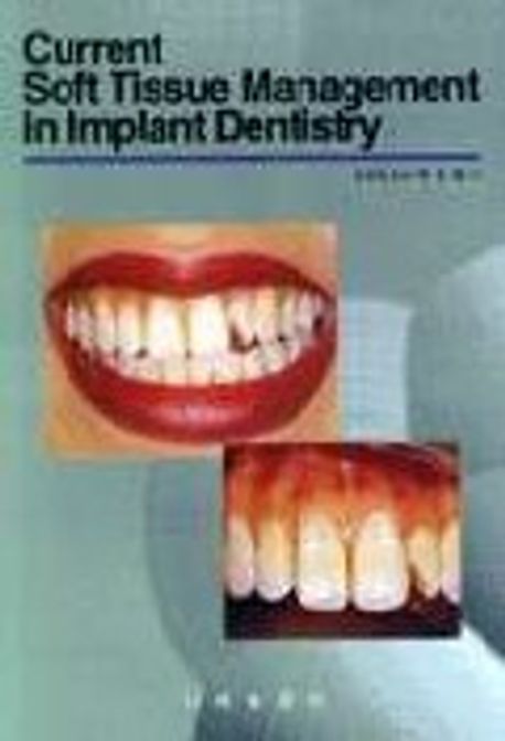 CURRENT SOFT TISSUE MANAGEMENT IN IMPLANT DENTISTRY | 박광범 - 교보문고