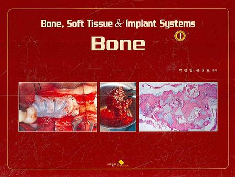 BONE SOFT TISSUE & IMPLANT SYSTEMS 1 (BONE) | 박광범 - 교보문고