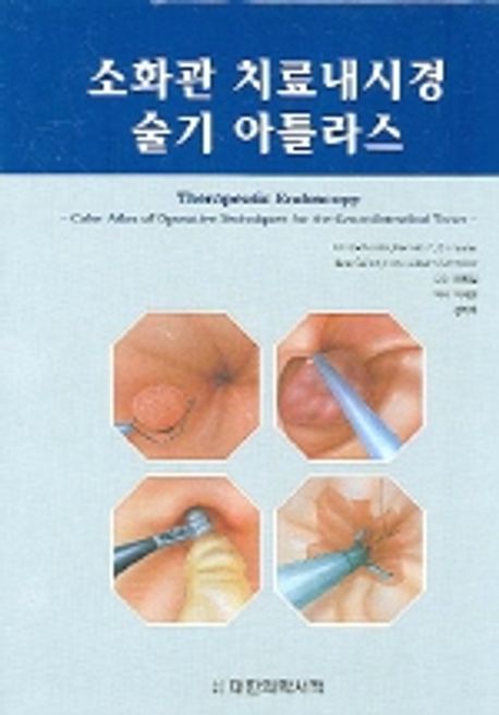 소화관 치료내시경 술기 아틀라스 | NIB SOEHENDRA - 교보문고