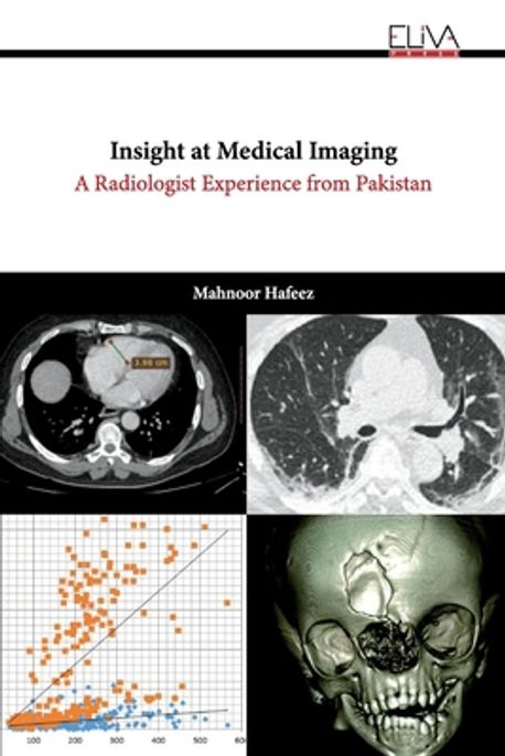 Insight at Medical Imaging | Hafeez, Mahnoor - 교보문고