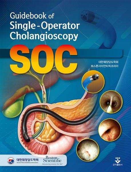 Guidebook of Single-Operator Cholangioscopy | 대한췌장담도학회 - 교보문고