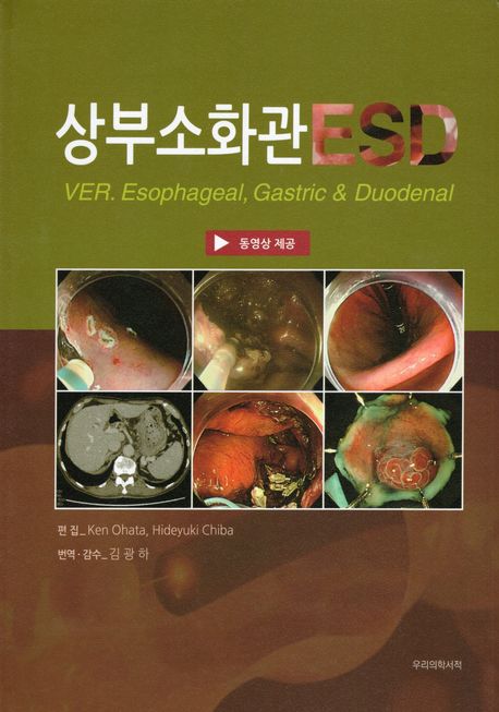 상부소화관 ESD | Ken Ohata - 교보문고