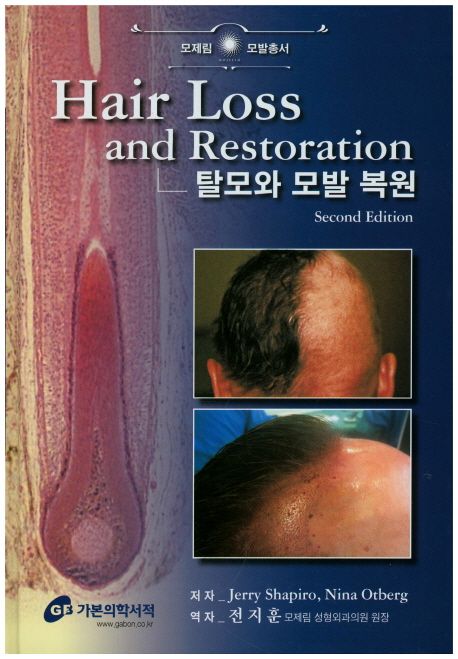 탈모와 모발 복원(Hair Loss and Restoration) | Jerry Shapiro - 교보문고