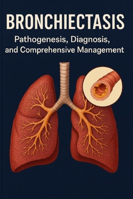 Bronchiectasis | Kasotiya, Rakesh - 교보문고