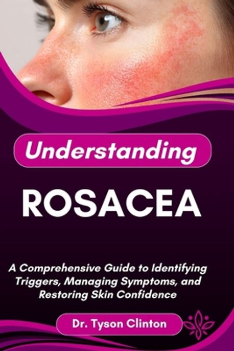 Understanding Rosacea | Clinton, Tyson - 교보문고
