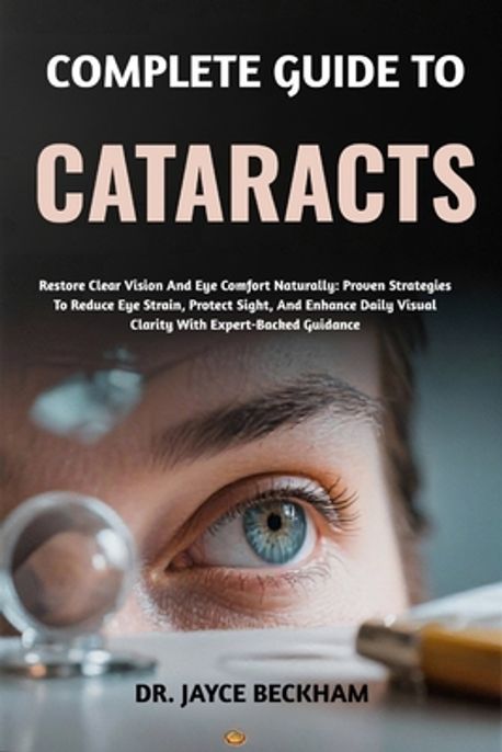 Complete Guide to Cataracts | Beckham, Jayce - 교보문고
