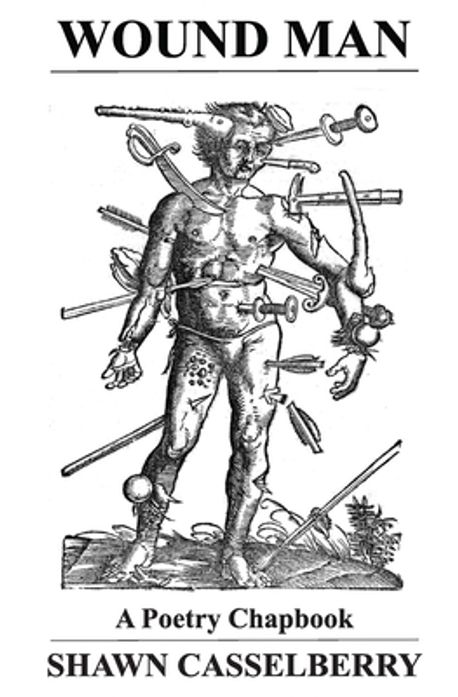 Wound Man | Casselberry, Shawn - 교보문고