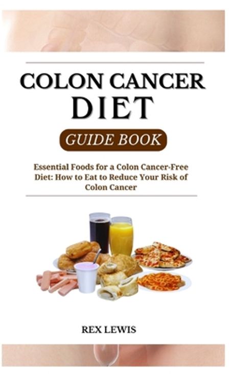 Colon Cancer Diet Guide Book | Lewis, Rex - 교보문고