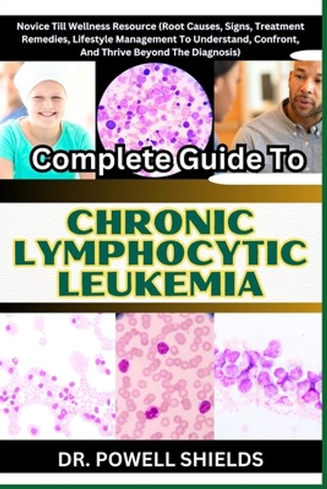 Complete Guide To CHRONIC LYMPHOCYTIC LEUKEMIA | Shields, Powell - 교보문고