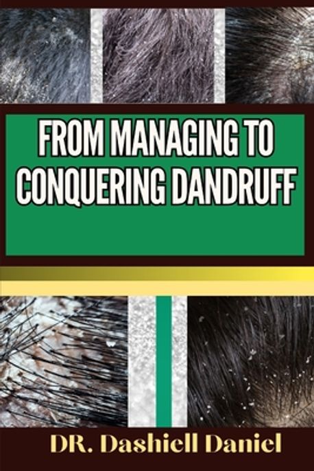From Managing to Conquering Dandruff | Daniel, Dashiell - 교보문고