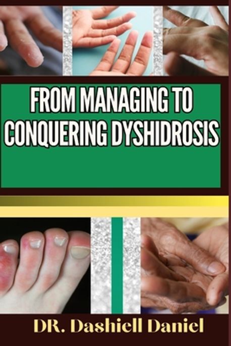 From Managing to Conquering Dyshidrosis | Daniel, Dashiell - 교보문고