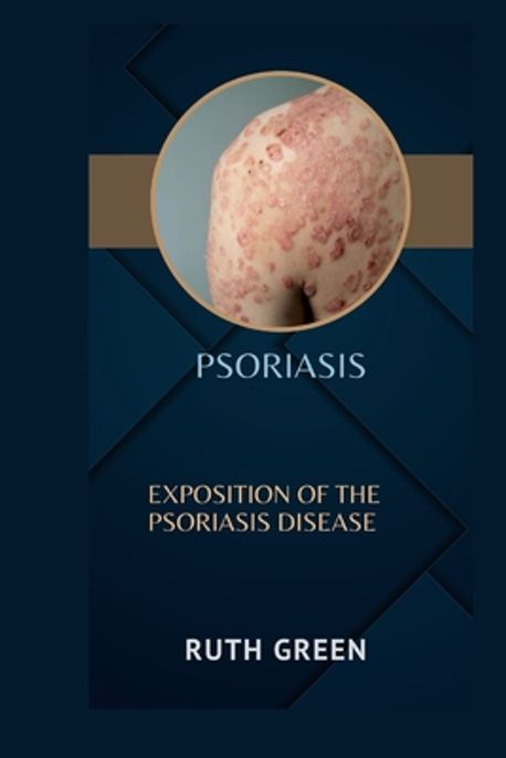 Psoriasis | Green, Ruth - 교보문고