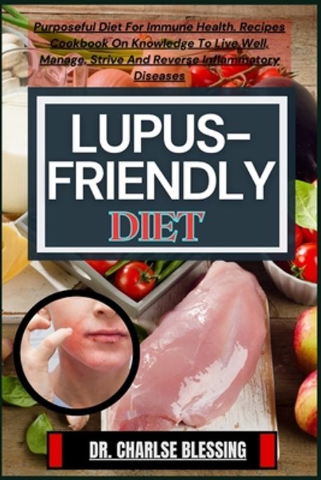 Lupus-Friendly Diet | Blessing, Charlse - 교보문고