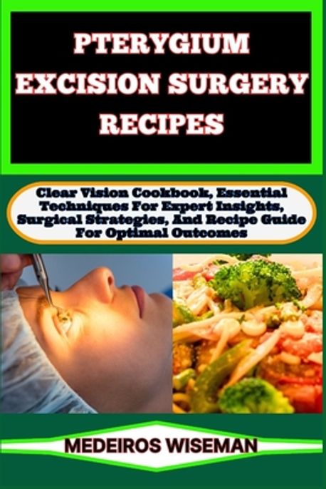Pterygium Excision Surgery Recipes | Wiseman, Medeiros - 교보문고