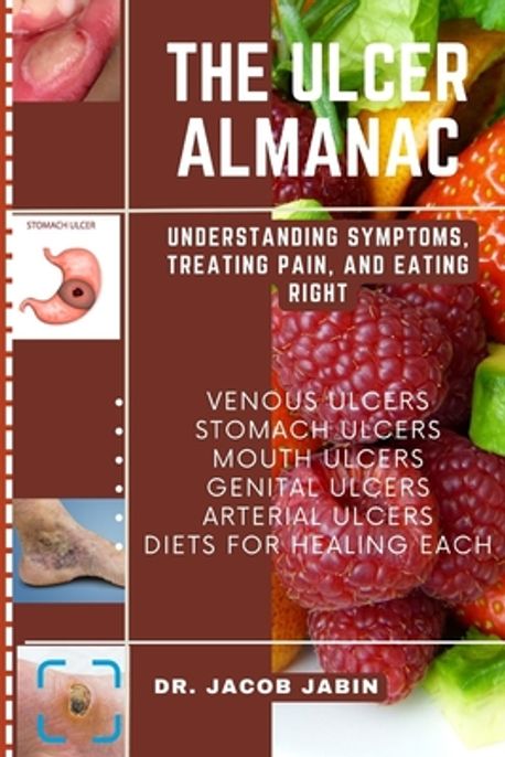 The ulcer almanac | Jabin, Jacob - 교보문고