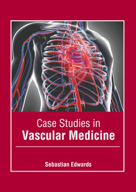 Case Studies in Vascular Medicine | Edwards, Sebastian - 교보문고